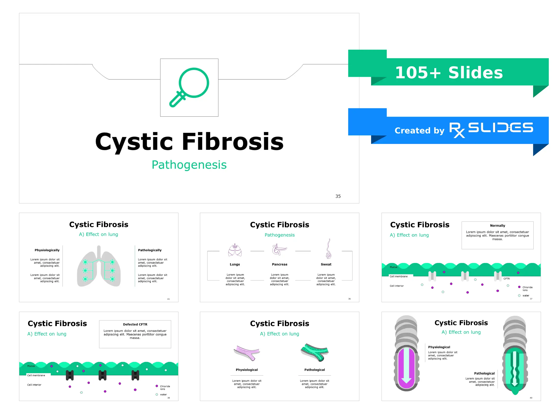 Download Cystic Fibrosis PowerPoint Template| RxSlides